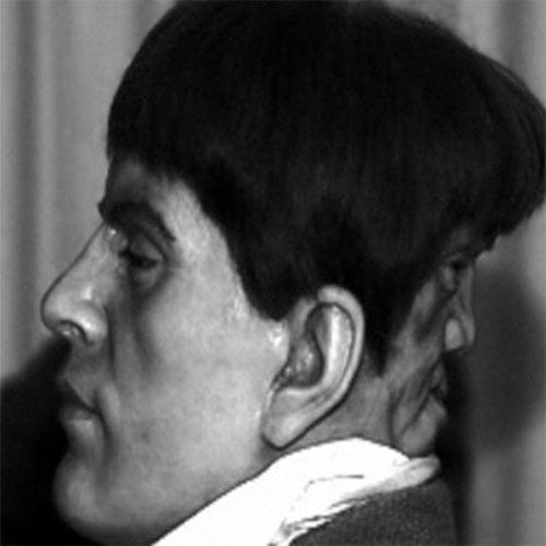 The Disturbing True Story Of Edward Mordrake - कभी देखा है दो चेहरे ...