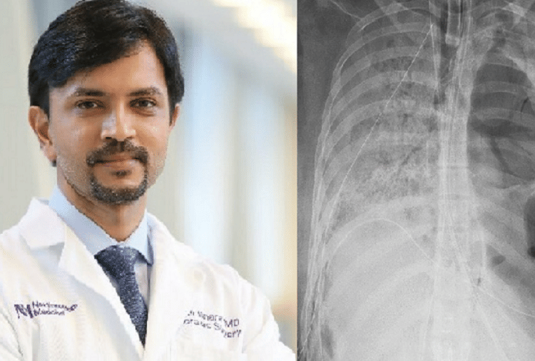 Indian-origin Doctor Ankit Bharat Successfully Transplanted Both Lungs ...
