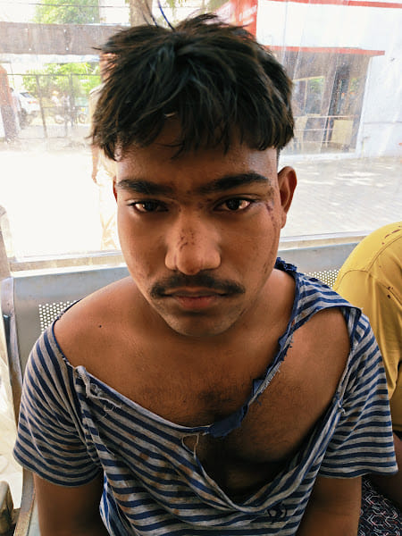Seven People Injured In A Bloody Clash Between Two Parties Over A Loan ...