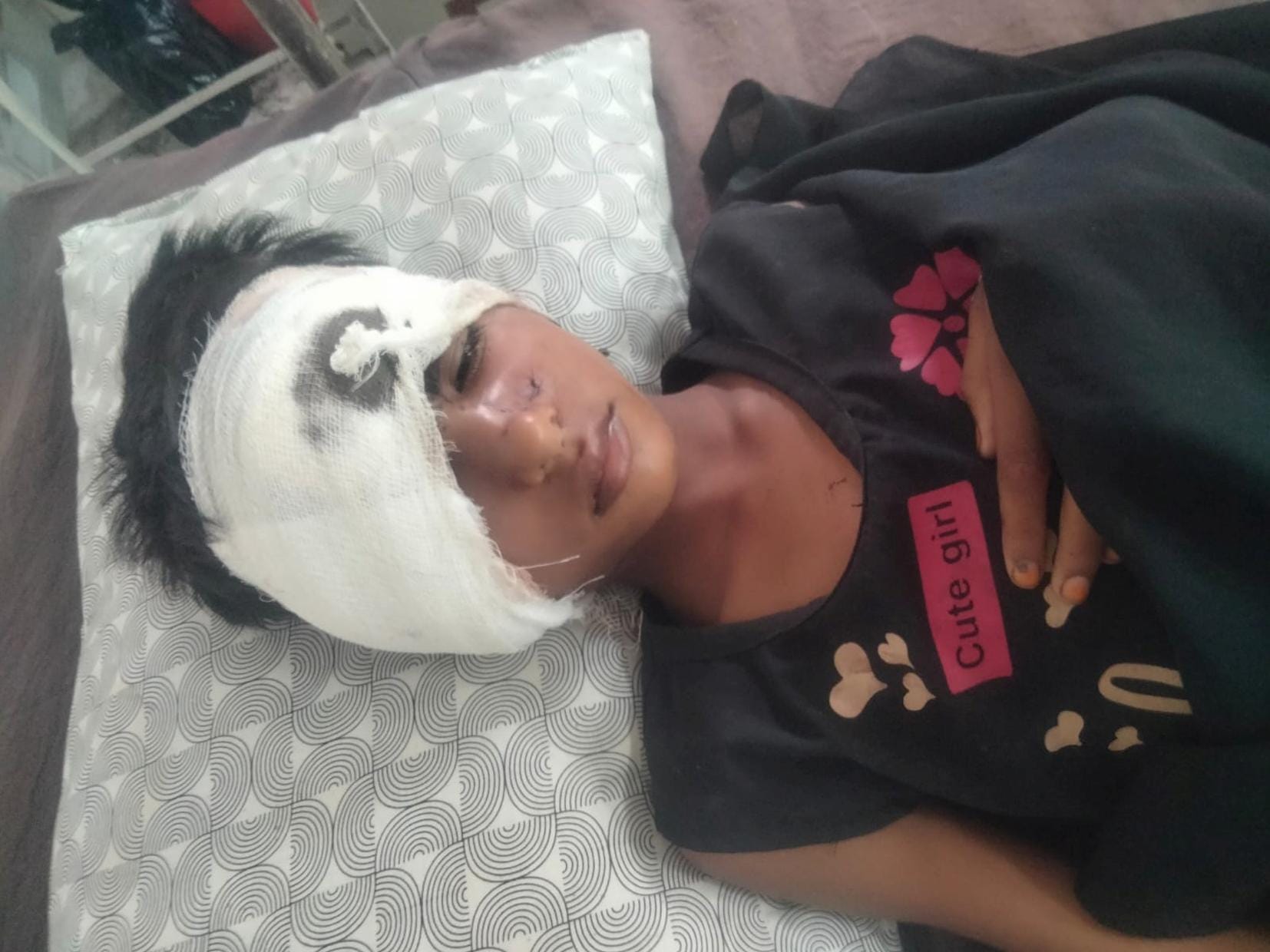 Two Wolf Attacks In 45 Minutes, Two Children Injured - Bahraich News ...