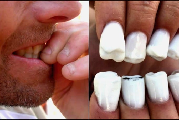 Hilarious Tooth Nail Art You Never Seen Before - दुनिया वाले दांतों से ...