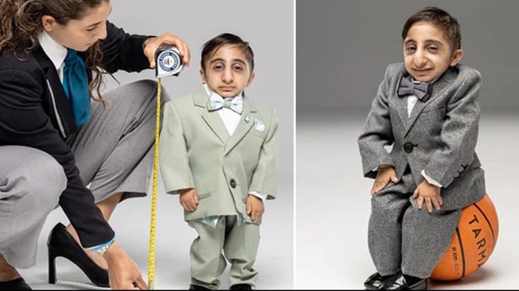 World's Shortest Man: Irans Afshin Ghaderzadeh Is Crowned The Worlds ...